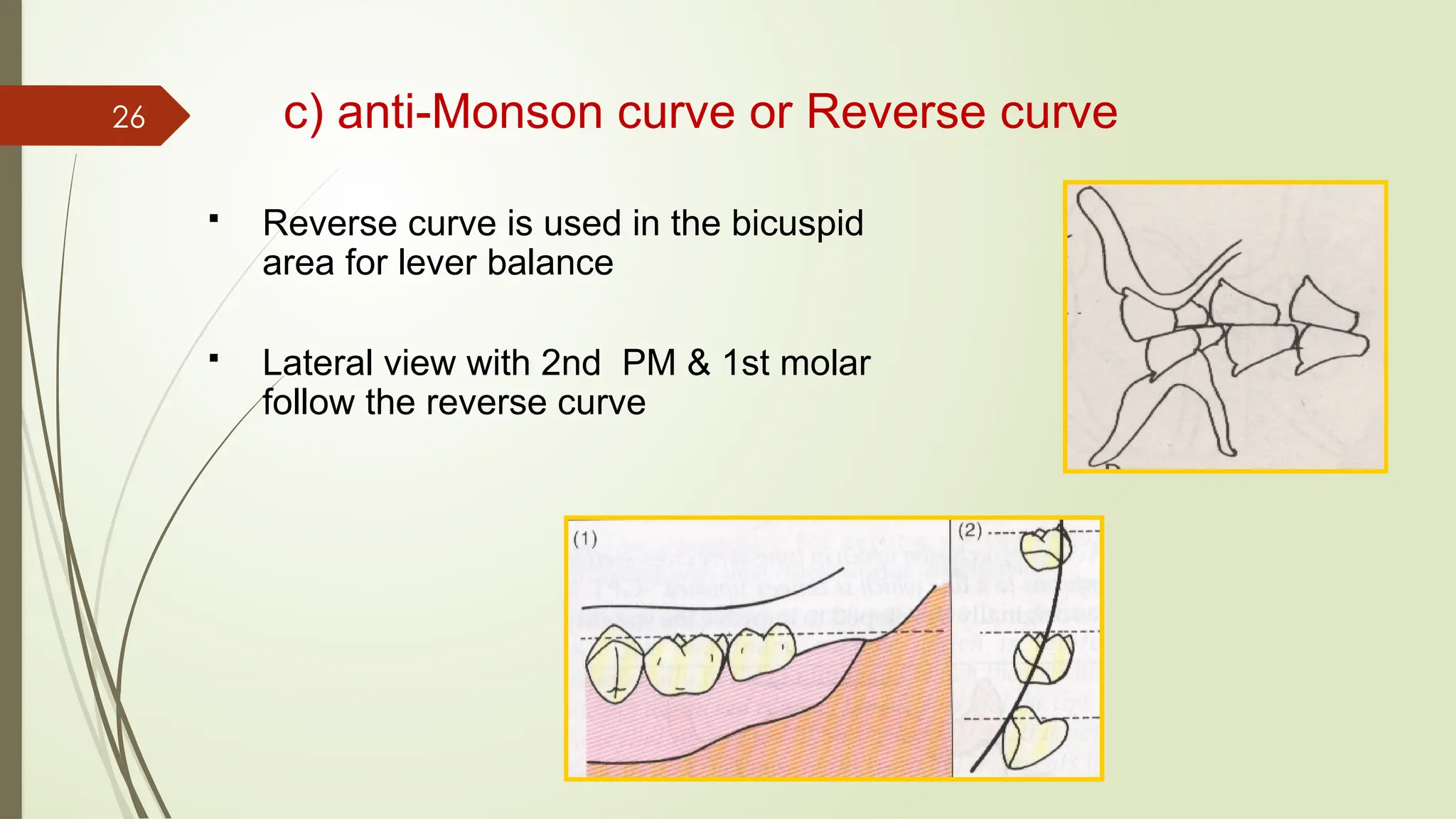 Occlusion in CD.pptx