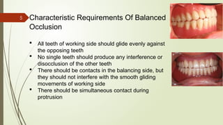 Occlusion in CD.pptx
