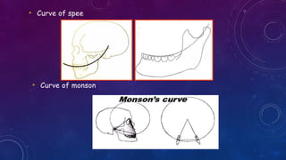 Occlusion in complete denture-1.pptx occlusion | PPTX