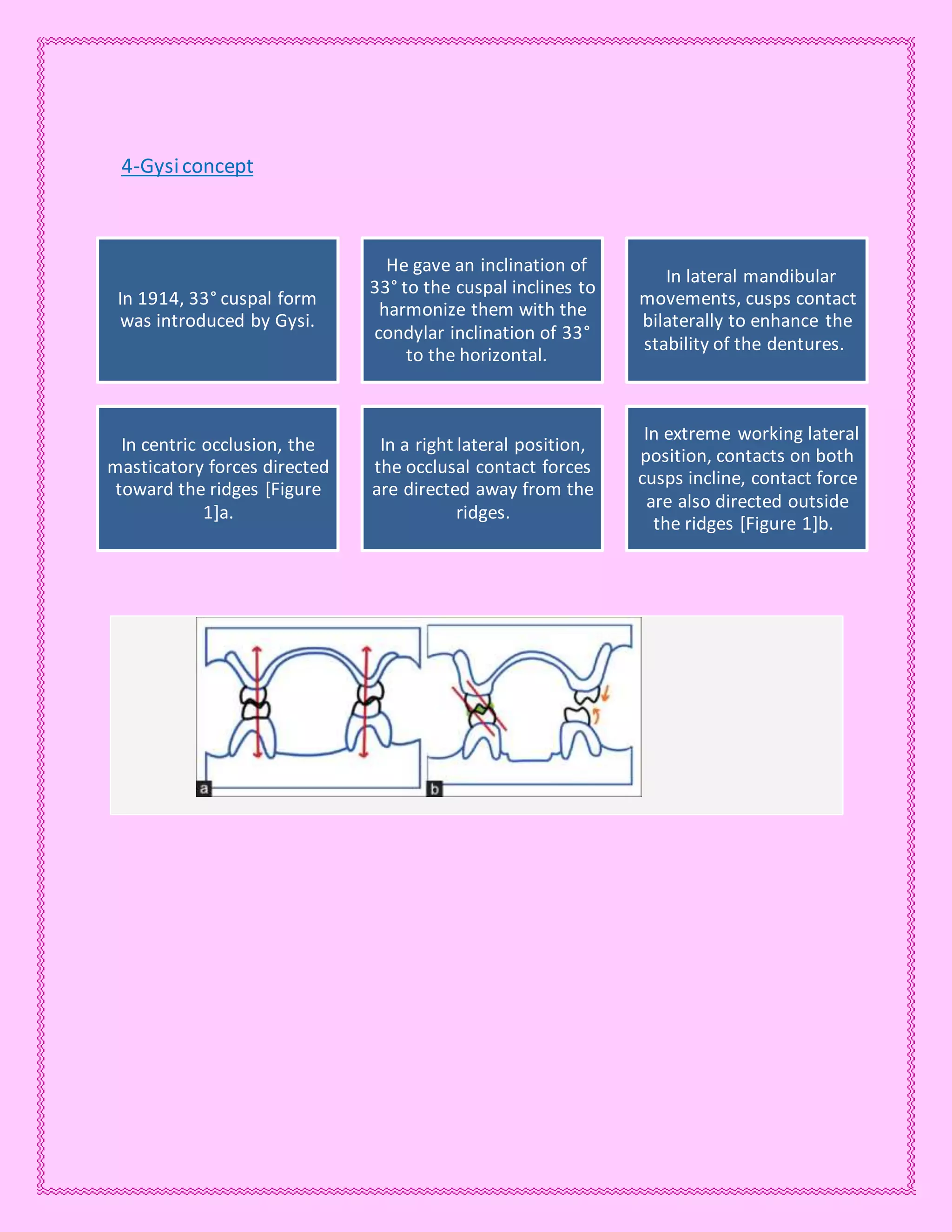 Occlusion in complete denture | DOCX