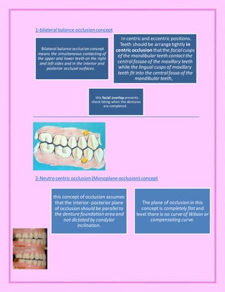 Occlusion in complete denture | DOCX | Dental Health | Diseases and ...