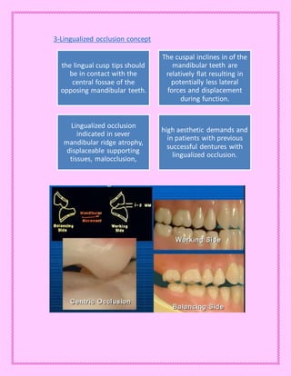 Occlusion in complete denture | DOCX | Dental Health | Diseases and ...