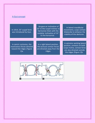 Occlusion in complete denture | DOCX | Dental Health | Diseases and ...