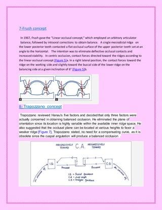 Occlusion in complete denture | DOCX | Dental Health | Diseases and ...
