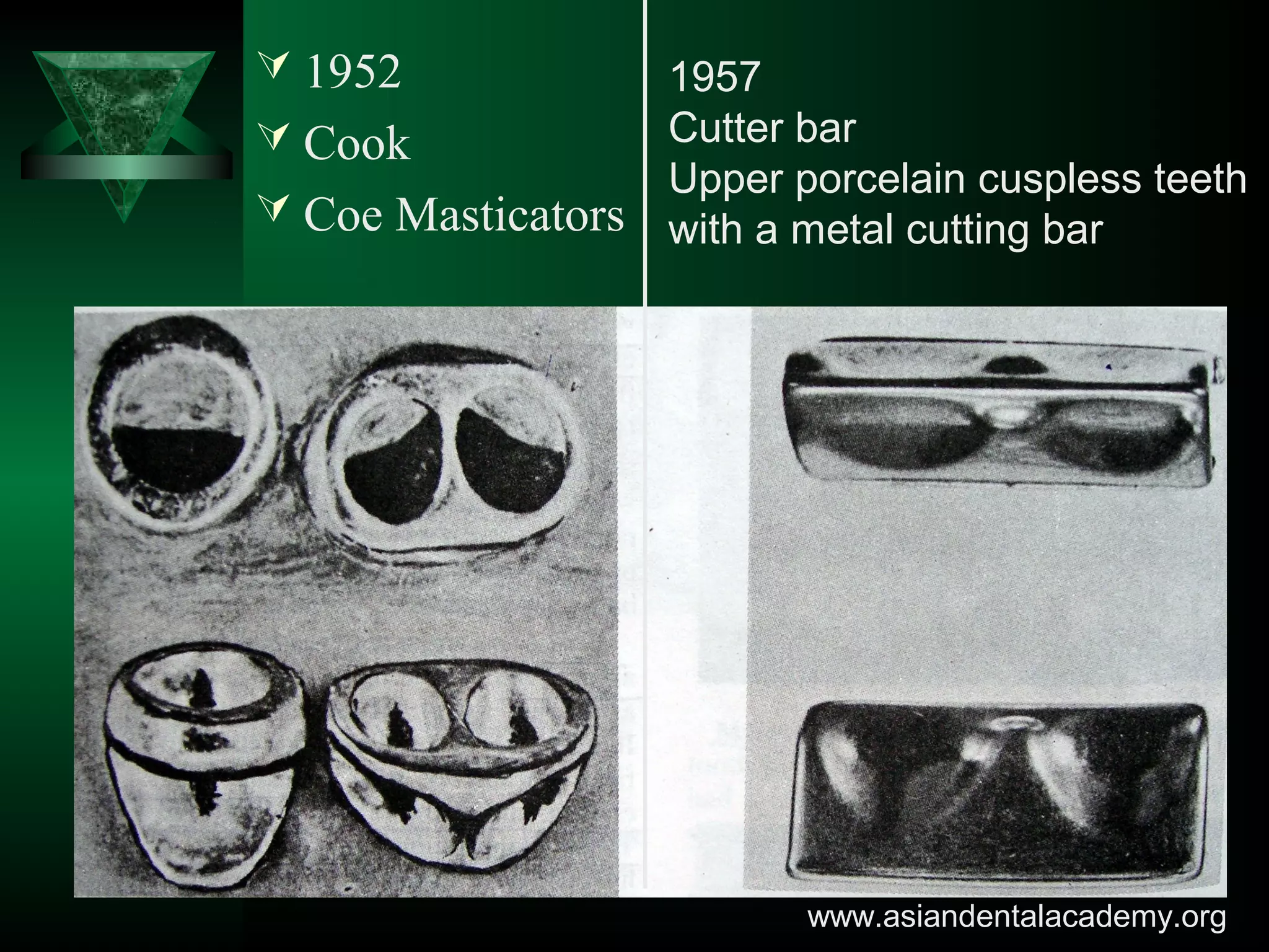 Occlusion in complete denture | PPT