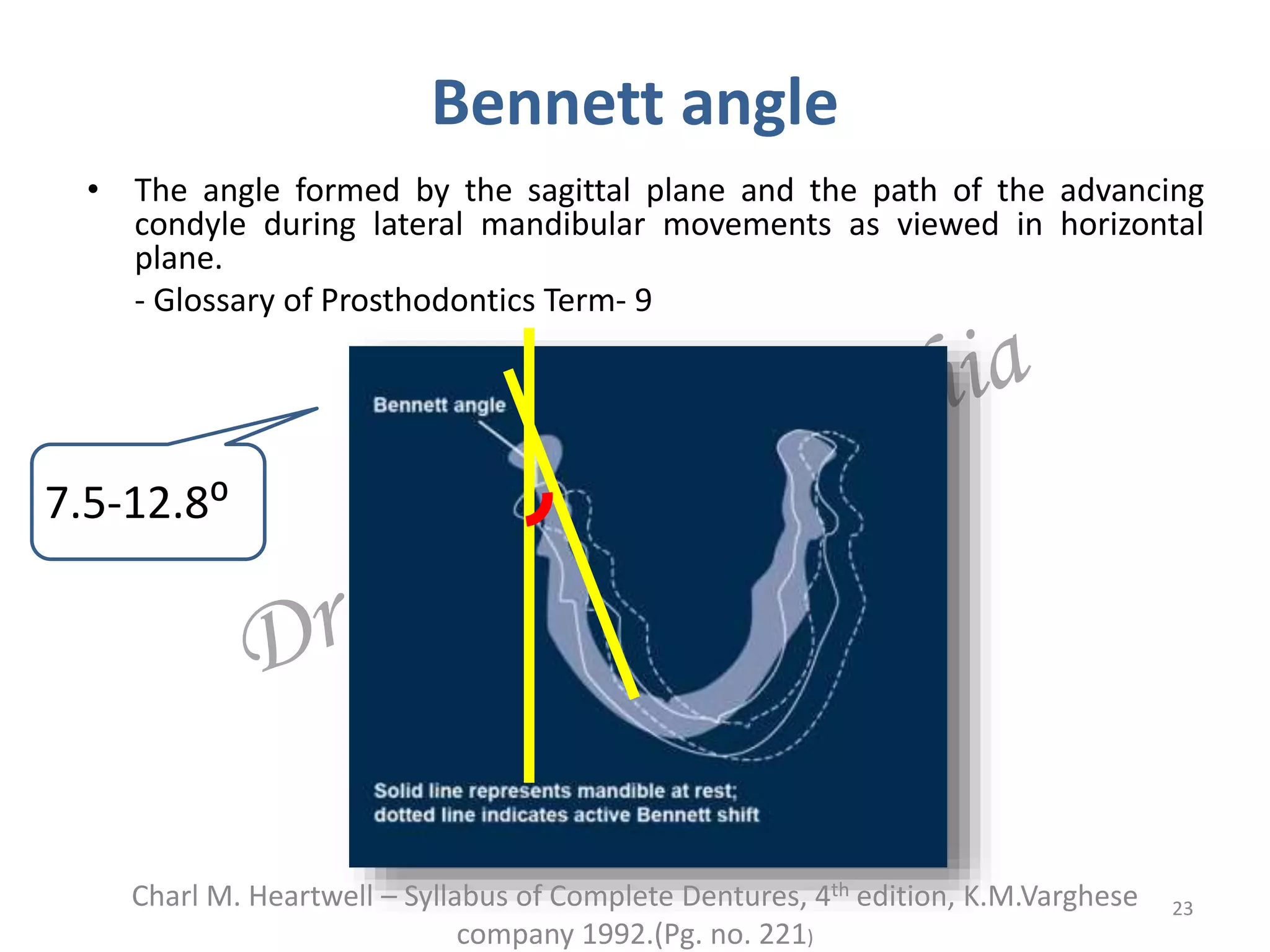Occlusion in Complete Denture | PPTX