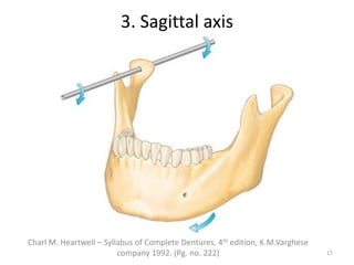 Occlusion in Complete Denture | PPTX