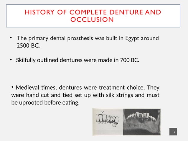 OCCLUSION IN COMPLETE DENTURE - Copy.pptx