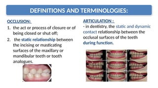 OCCLUSION IN COMPLETE DENTURE presentation.pptx