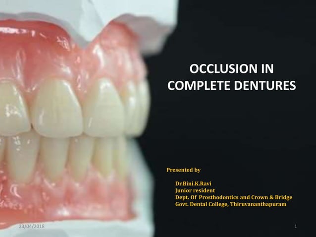 OCCLUSION IN COMPLETE DENTURES.pptx | Dental Health | Diseases and Conditions