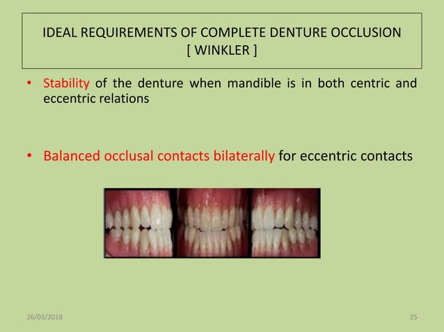 OCCLUSION IN COMPLETE DENTURES.pptx | Dental Health | Diseases and ...