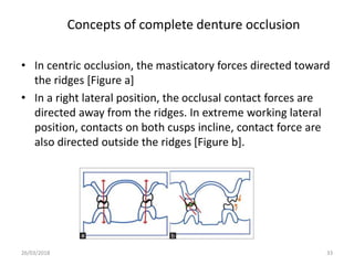 OCCLUSION IN COMPLETE DENTURES.pptx