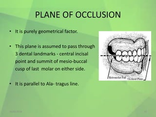 OCCLUSION IN COMPLETE DENTURES.pptx