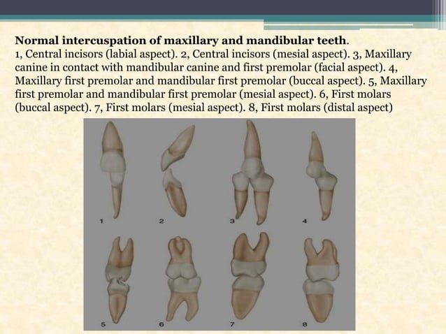 Occlusion in dentistry | PPTX | Dental Health | Diseases and Conditions