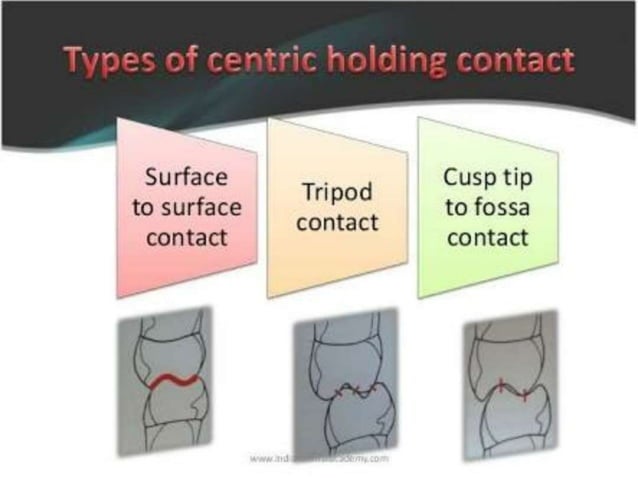 Occlusion in dentistry | PPTX | Dental Health | Diseases and Conditions