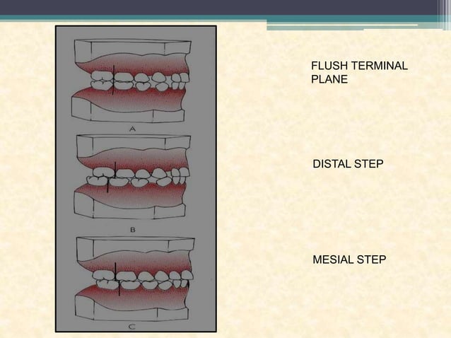 Occlusion in dentistry | PPTX | Dental Health | Diseases and Conditions