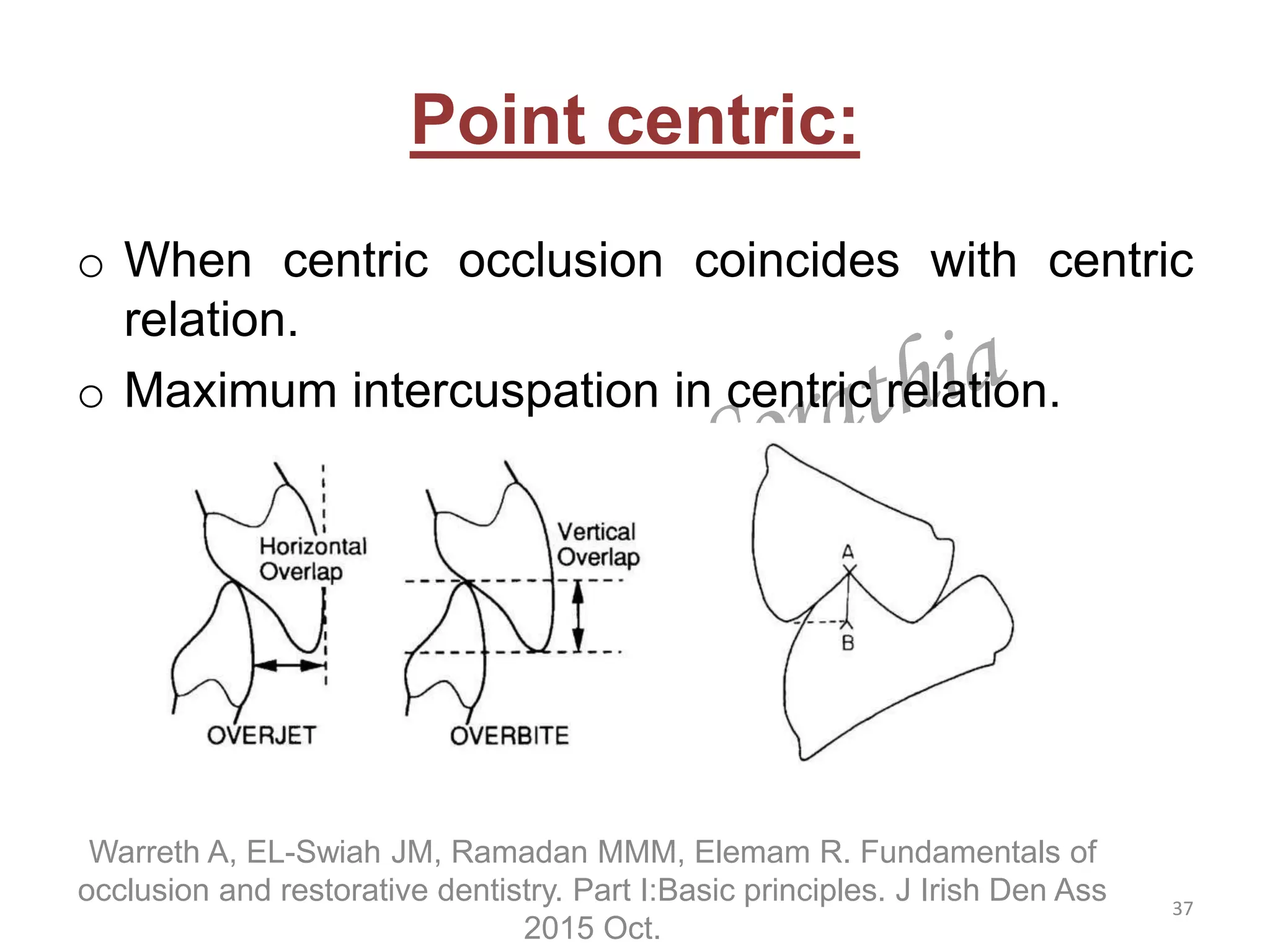 Occlusion in Fixed Dental Prosthesis | PPTX