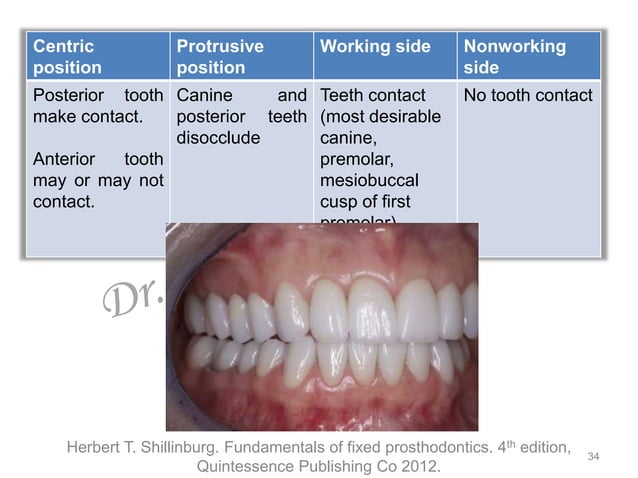 Occlusion in Fixed Dental Prosthesis | PPTX | Dental Health | Diseases ...