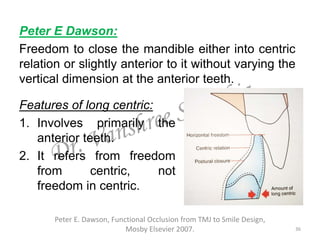 Occlusion in Fixed Dental Prosthesis | PPTX