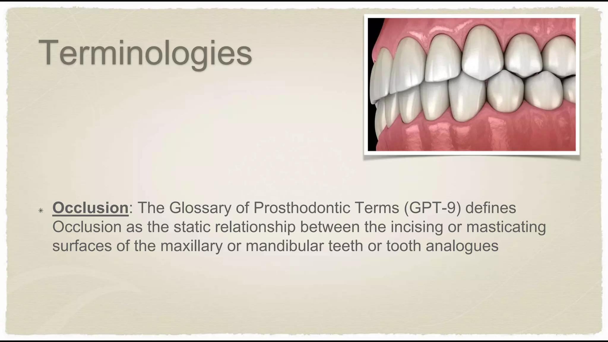 Occlusion in fixed partial denture | PPTX