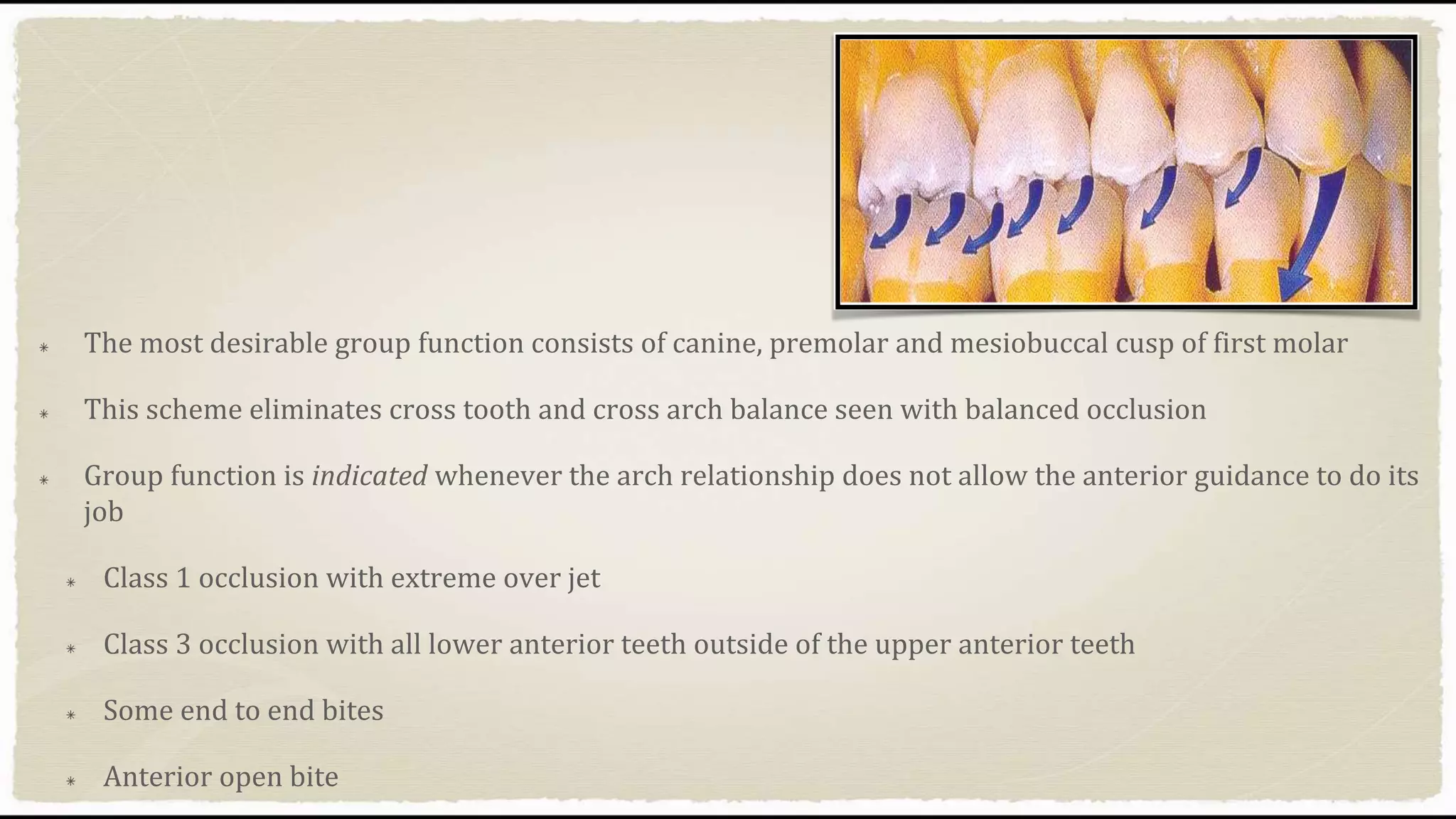 Occlusion in fixed partial denture | PPTX