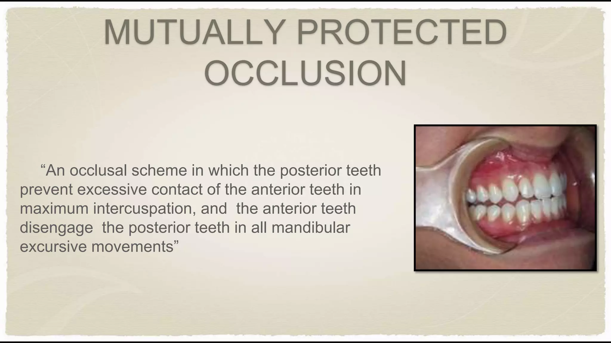 Occlusion in fixed partial denture | PPTX