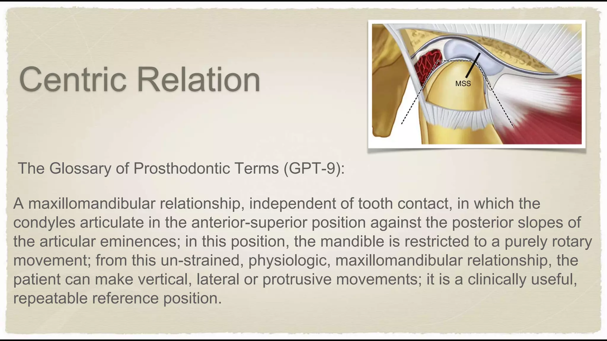 Occlusion in fixed partial denture | PPTX