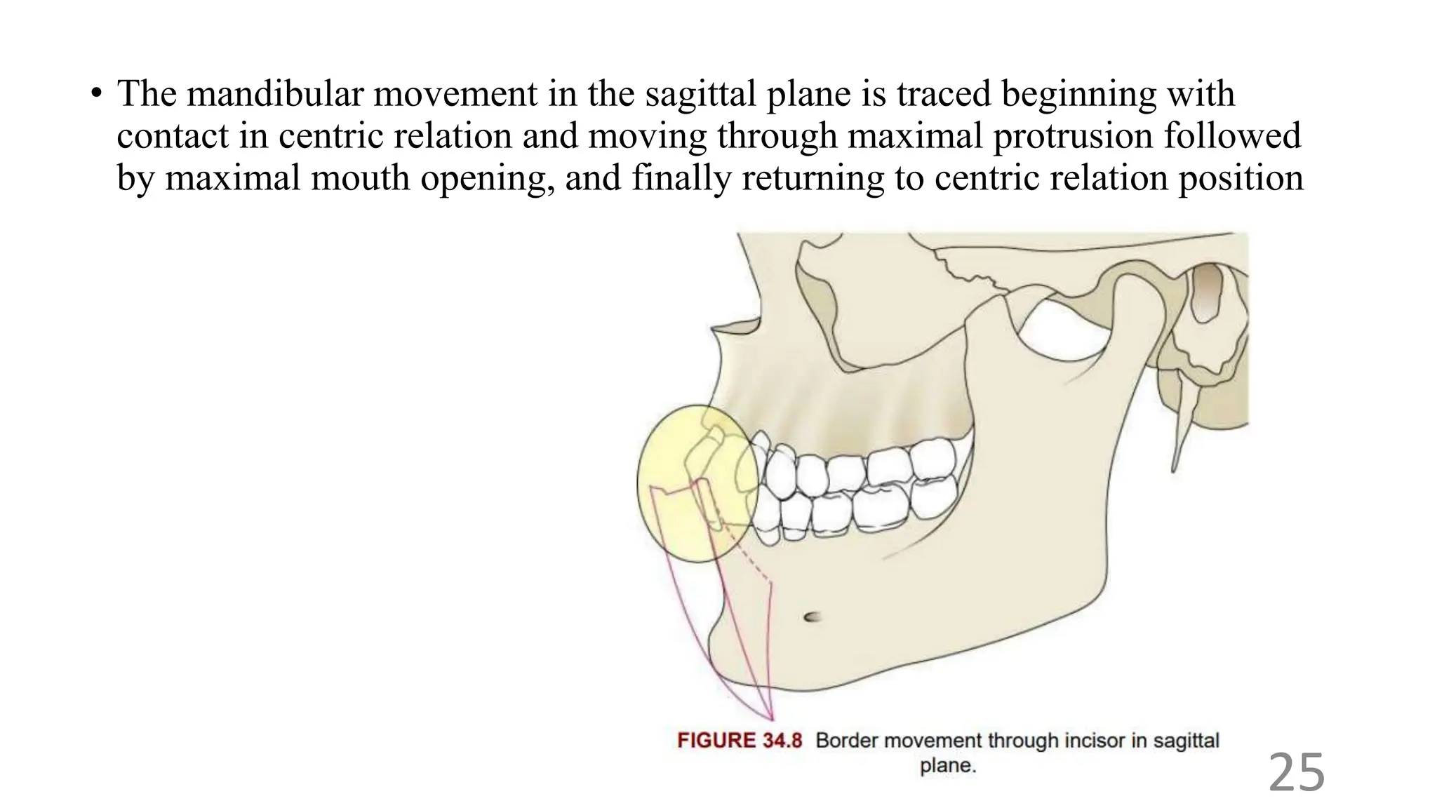 OCCLUSION IN FPD prosthodontics seminar final year | PPTX