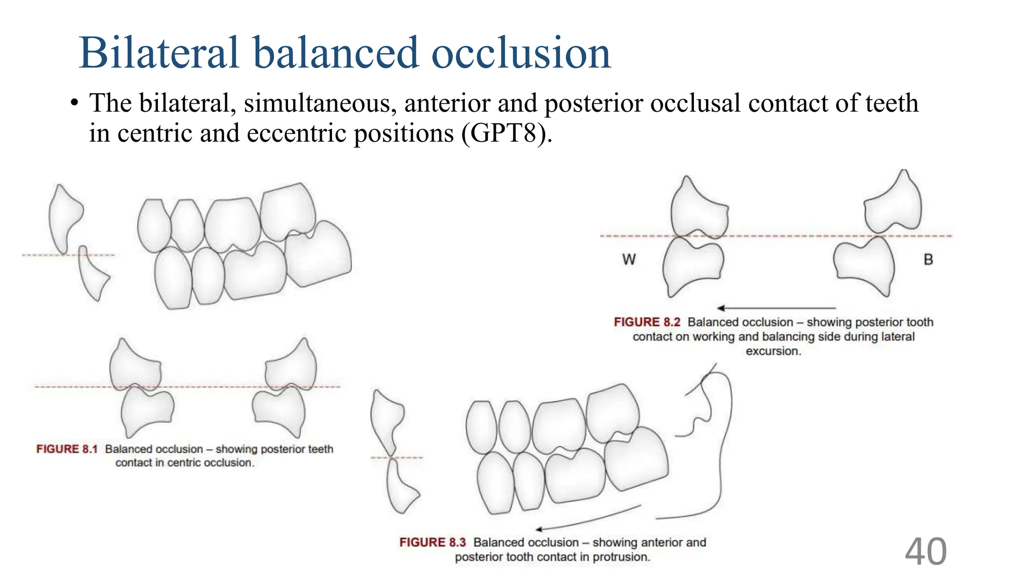 OCCLUSION IN FPD prosthodontics seminar final year | PPTX