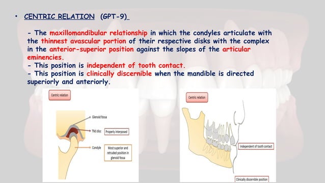 OCCLUSION IN FIXED PARTIAL DENTURE .pptx