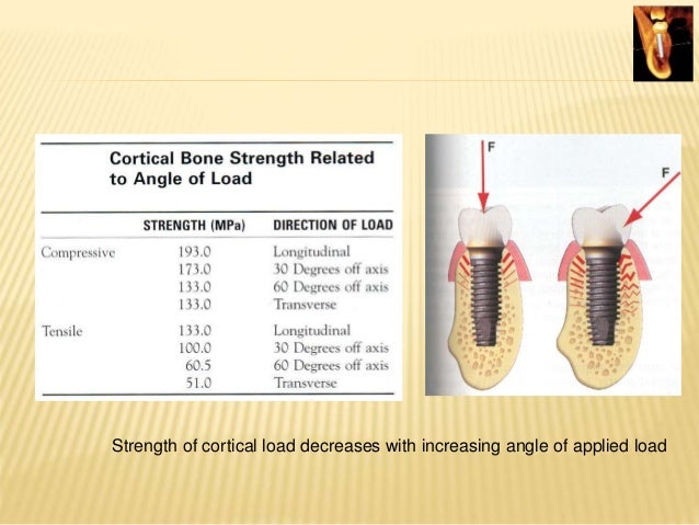 Occlusion in implant ss