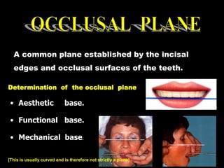 Occlusion in prosthodontics (Revision for 5th year students) | PPT