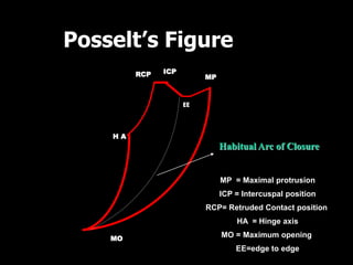 Occlusion in prosthodontics (Revision for 5th year students) | PPT