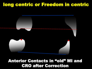 Occlusion in prosthodontics (Revision for 5th year students) | PPT