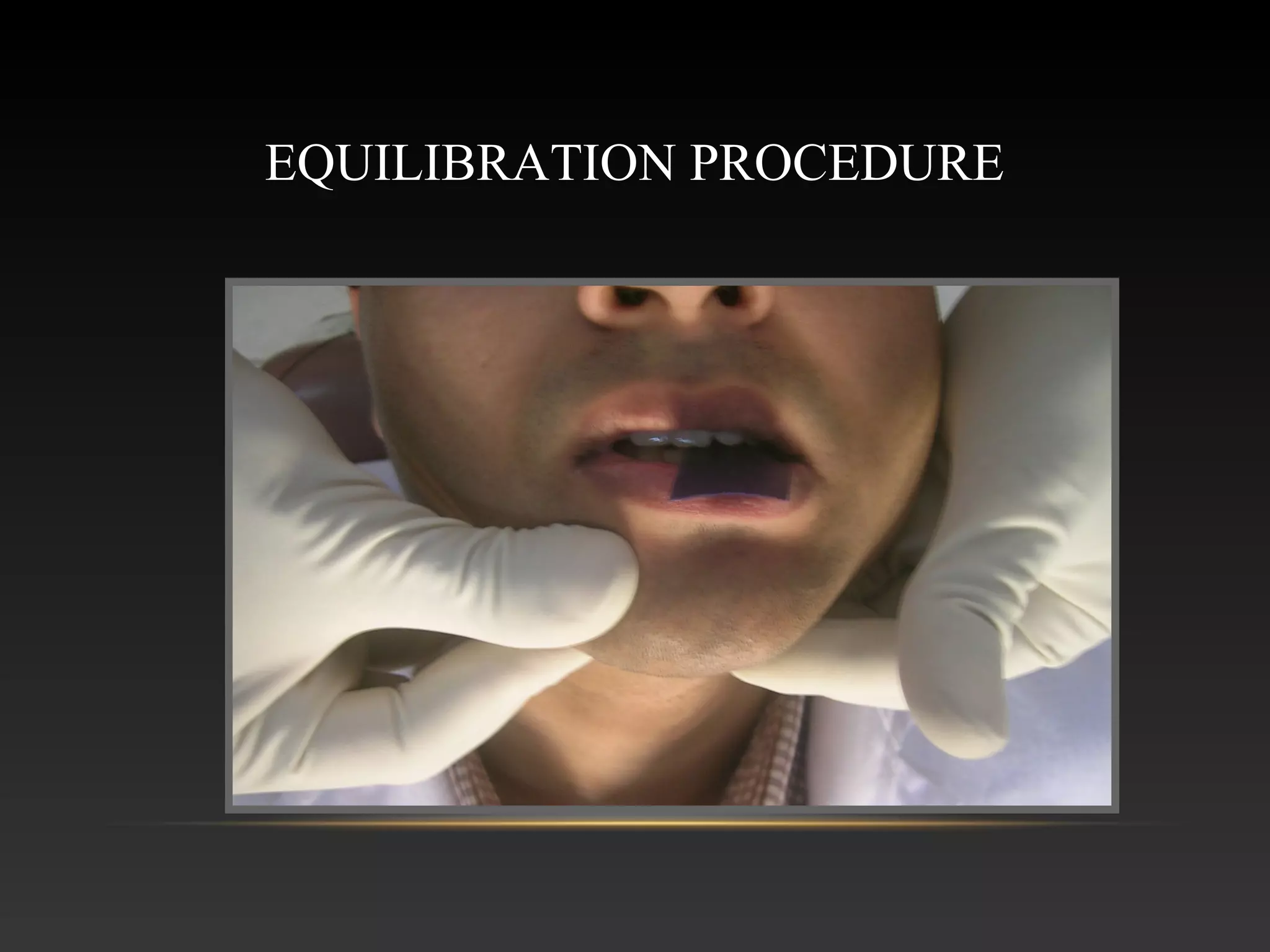 Occlusion in removable partial Denture | PPT