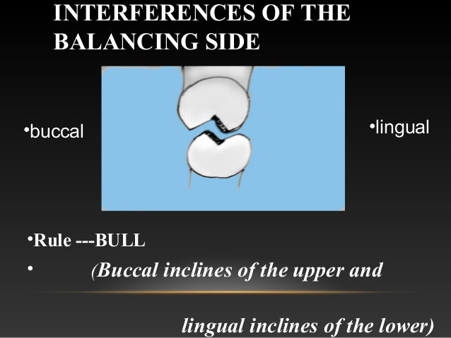 Occlusion in removable partial Denture
