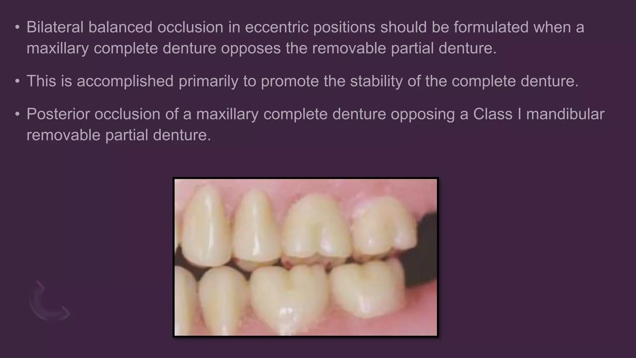 Occlusal Relationship in Removable partial denture | PPTX