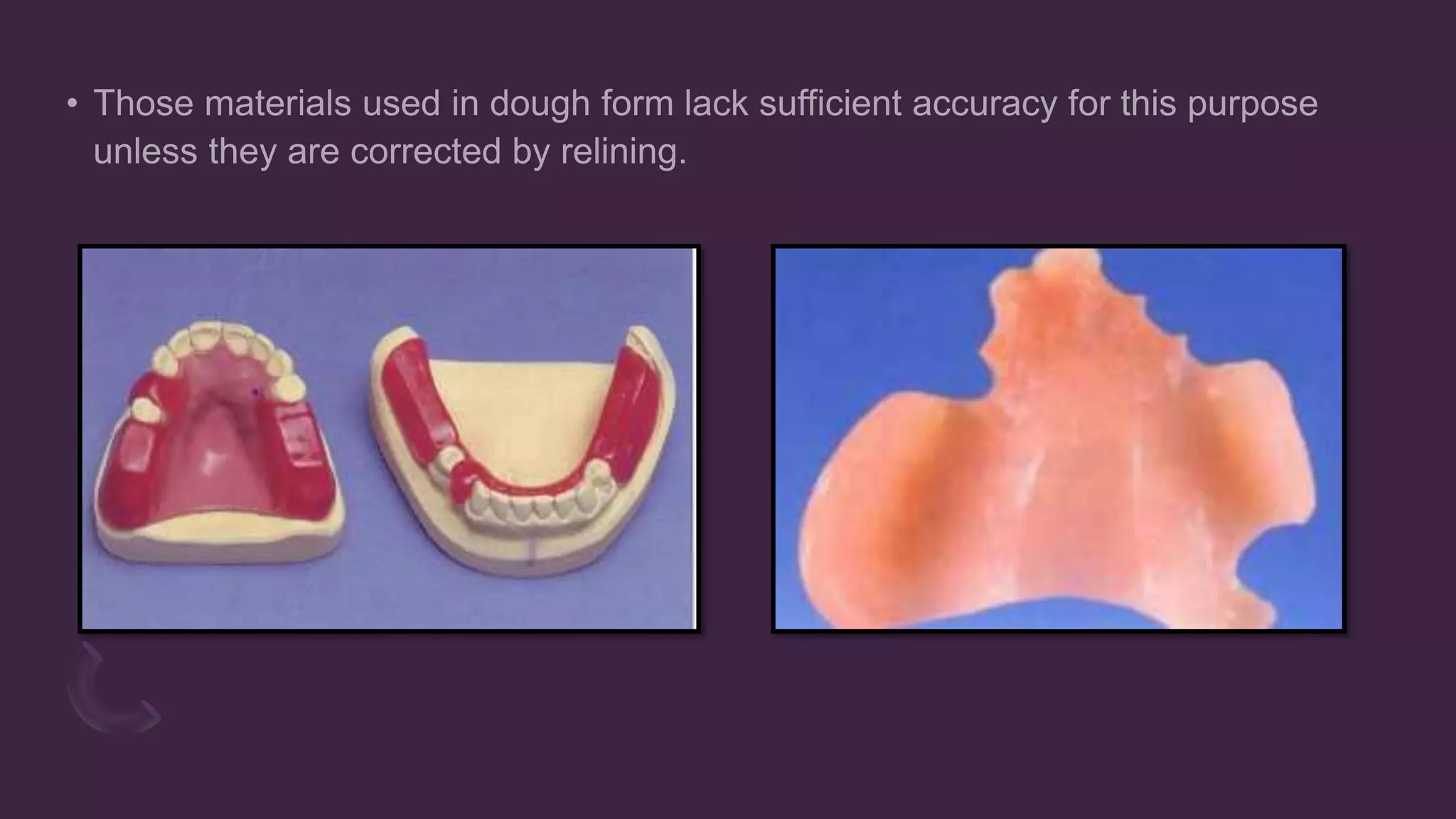 Occlusal Relationship in Removable partial denture | PPTX