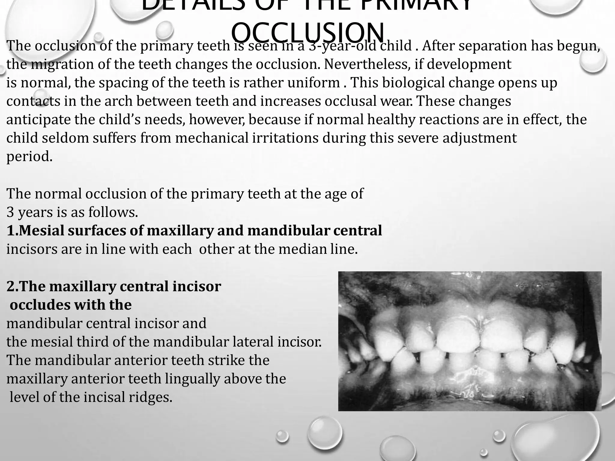 OCCLUSION | PPTX