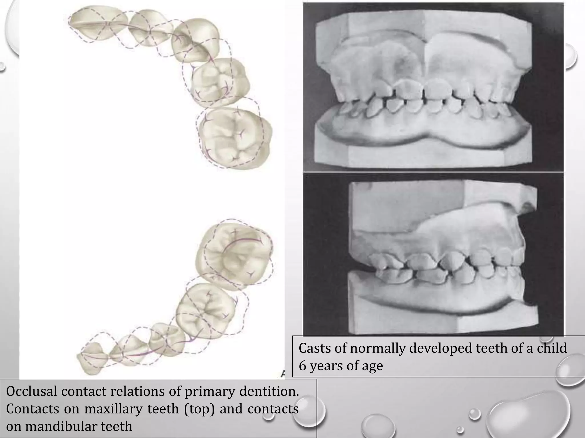 OCCLUSION | PPTX