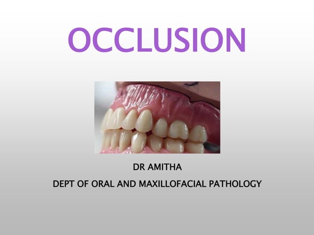 OCCLUSION | PPTX