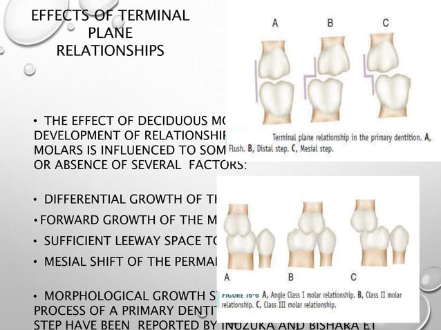 OCCLUSION | PPTX