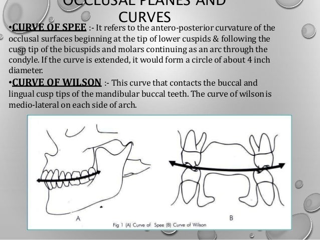 OCCLUSION