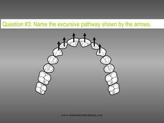 Occlusion n articulatirs/ orthodontic continuing education | PPT