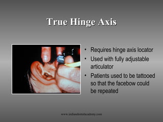 Occlusion n articulatirs/prosthodontic courses | PPT