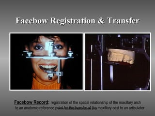 Occlusion n articulatirs/prosthodontic courses | PPT