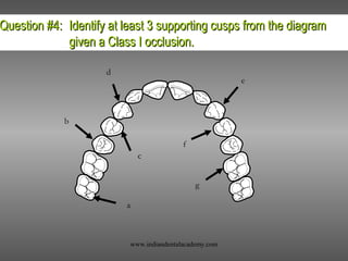 Occlusion n articulatirs/prosthodontic courses | PPT