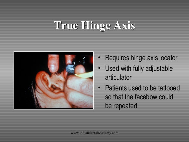 Occlusion n articulatirs/prosthodontic courses