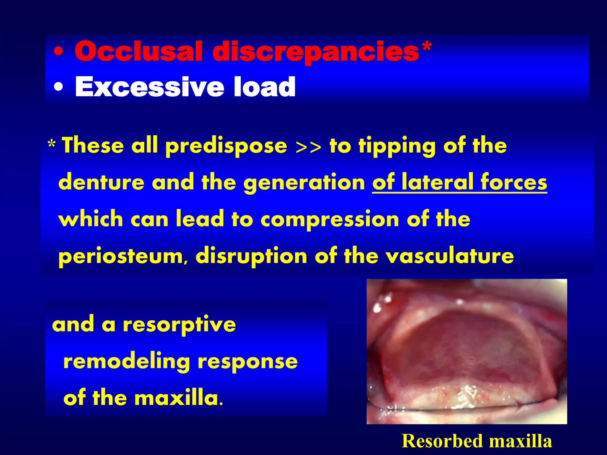 Occlusion of single denture (Management of Maxillary and Mandibular ...
