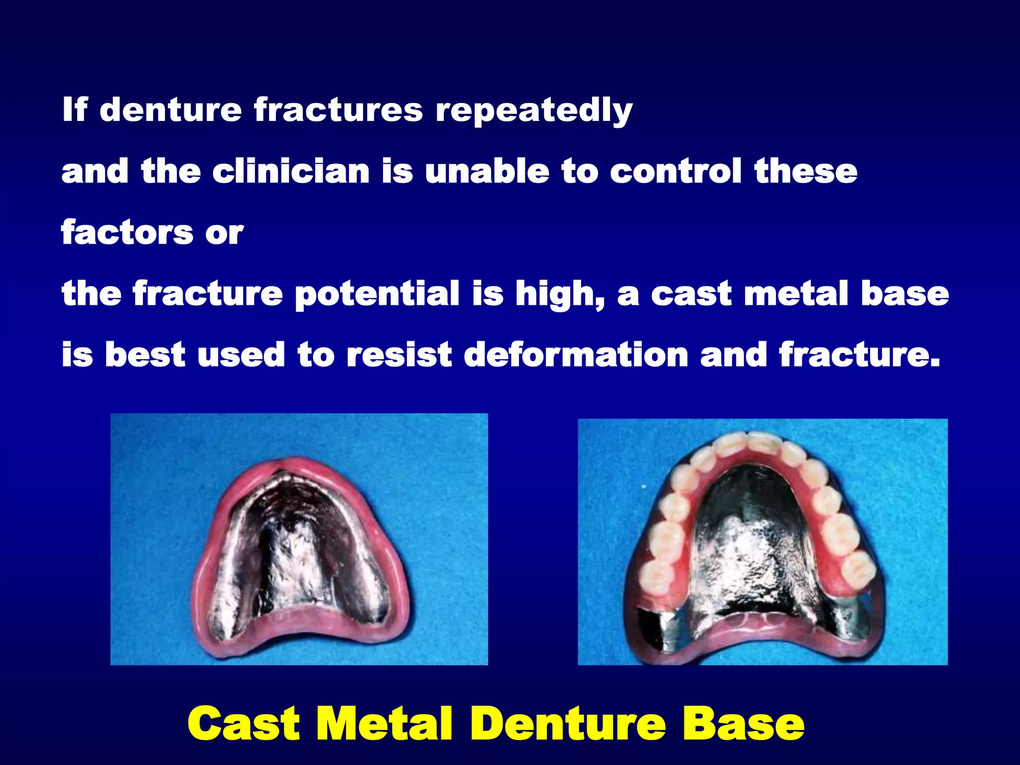 Occlusion of single denture (Management of Maxillary and Mandibular ...